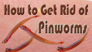 6 Easy Natural Home Remedies To Cure Pinworms - Yabibo