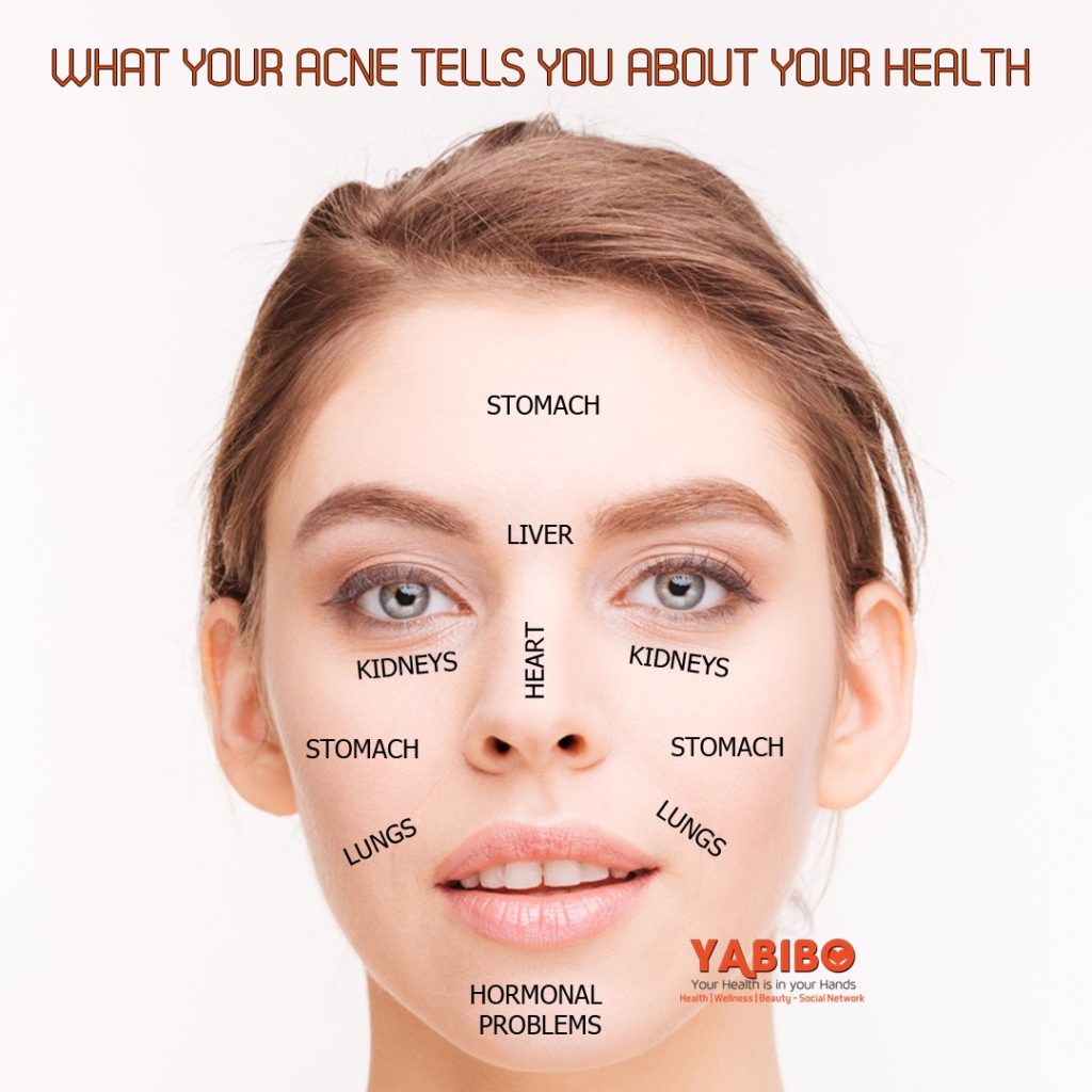 What Position of Acne tell about your Health Condition? - Yabibo