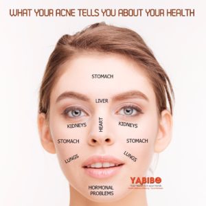 What Position of Acne tell about your Health Condition? - Yabibo