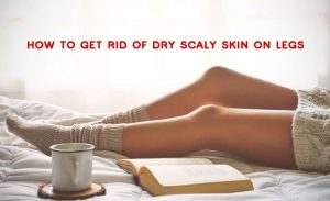 How to Get Rid of Dry Scaly Skin on Legs - Yabibo